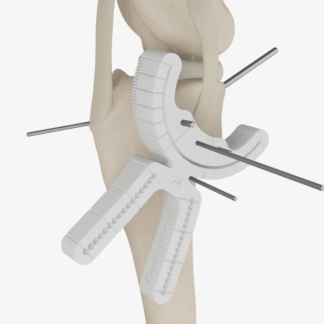Guided TPLO – OssAbility Limited