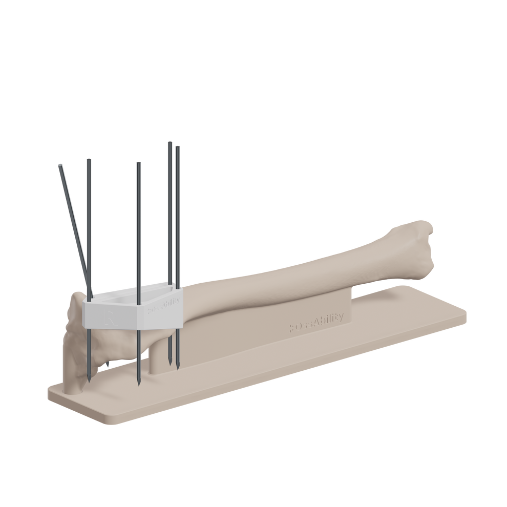 Patient Specific Guided TTA Training Kit – OssAbility Limited