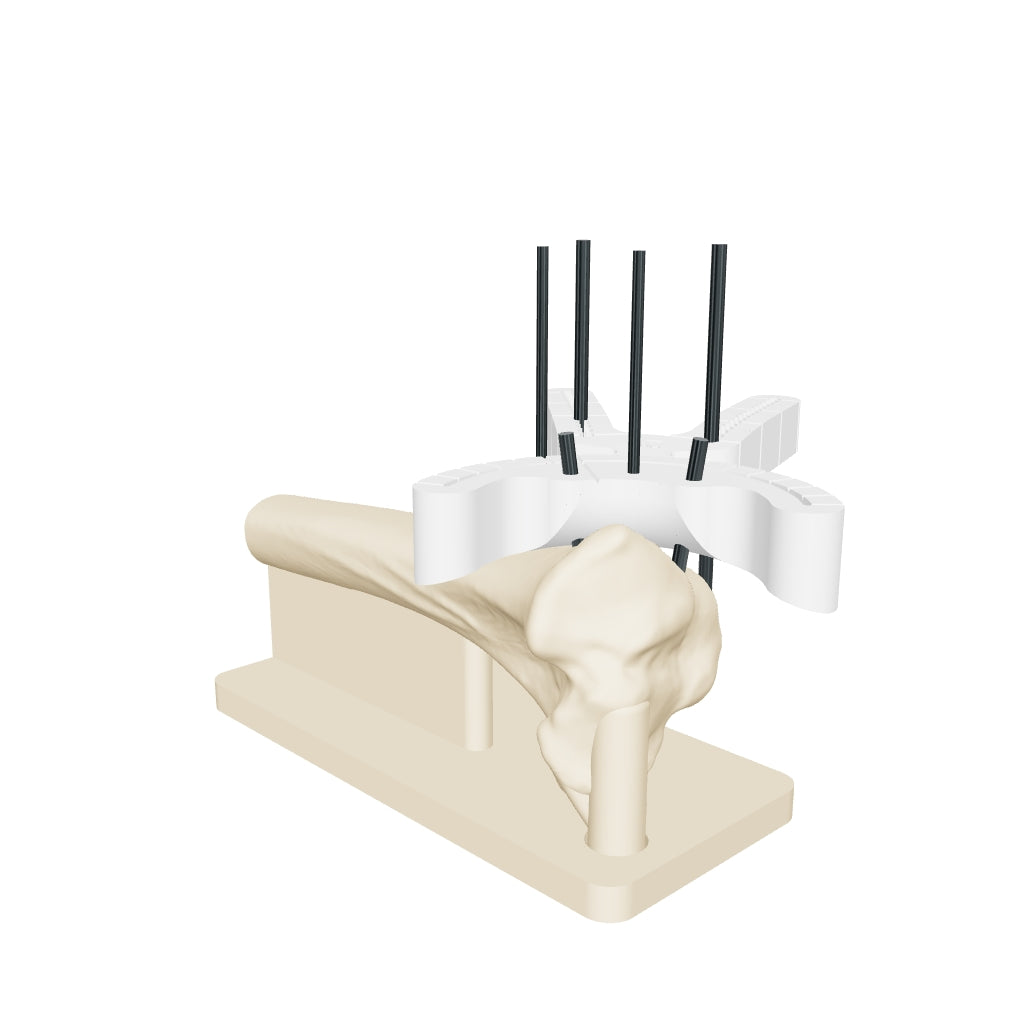 Guided TPLO – OssAbility Limited